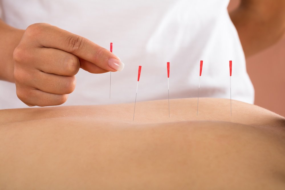 Fertility Acupressure Points: Top Techniques to Boost Fertility
