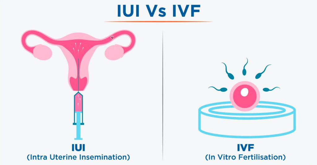 IUI vs IVF Comparison: Key Differences and Considerations
