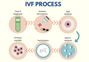 Fertility Treatment Timeline: IVF Process Stages & Tips